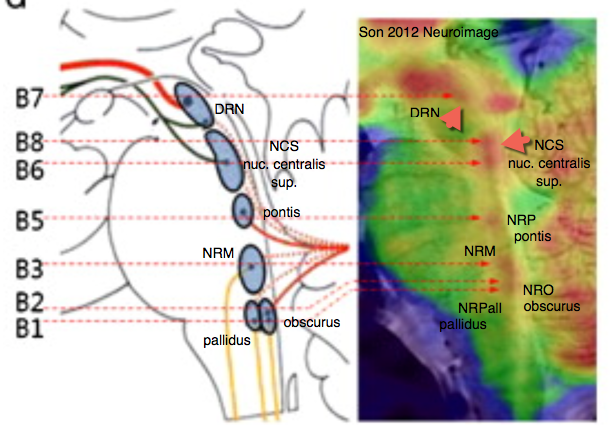 Raphe Nuclei Reticular Formation